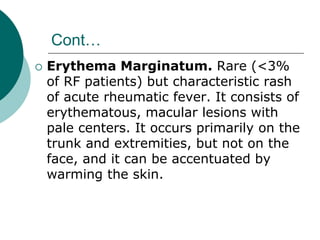10.Rheumatic Fever.ppt