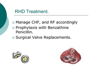 10.Rheumatic Fever.ppt