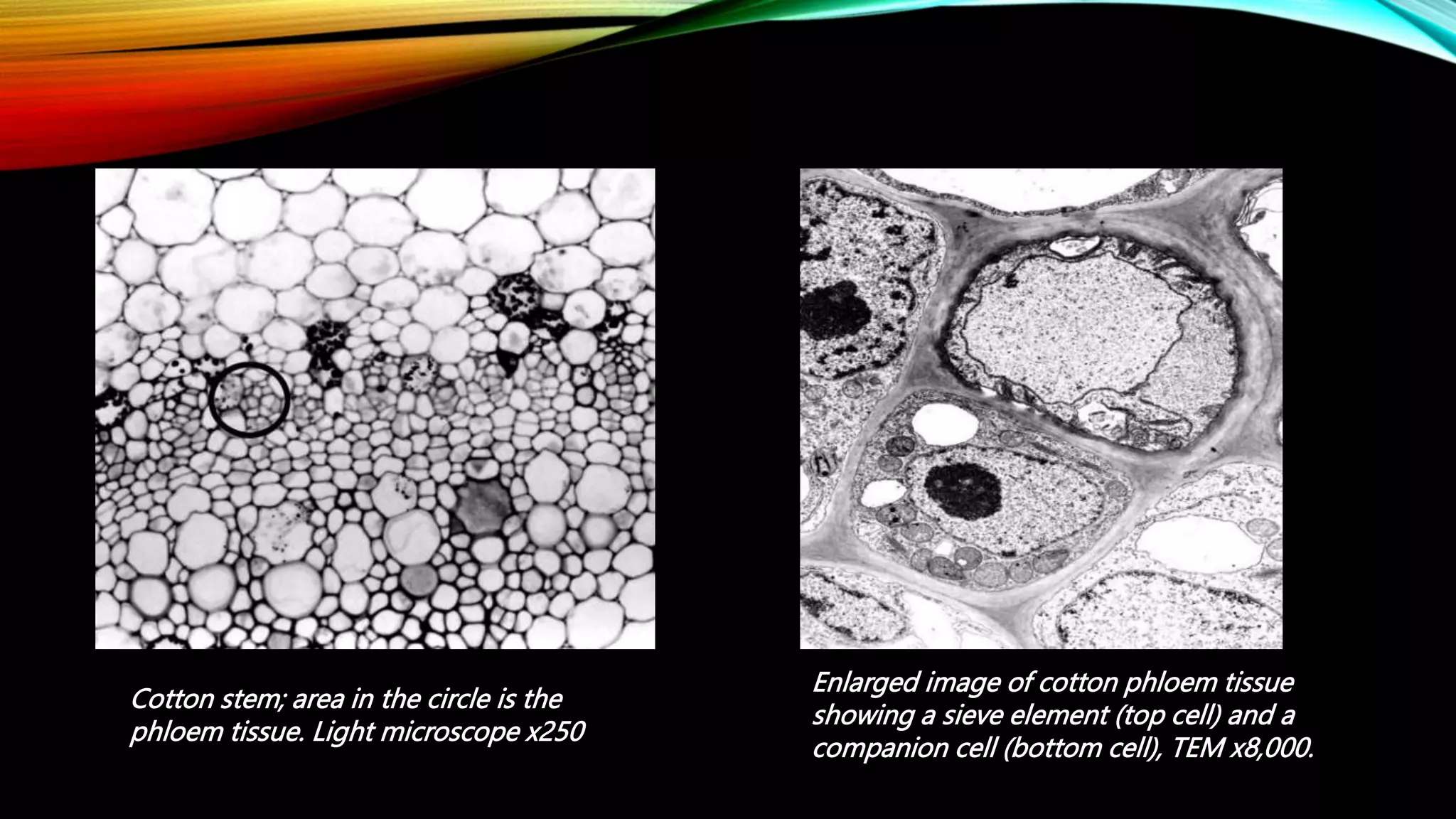 10. The Transmission Electron Microscope (TEM).pptx