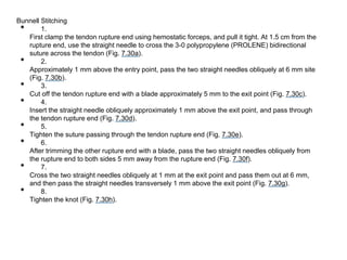 10. Damage to tendon .pptx