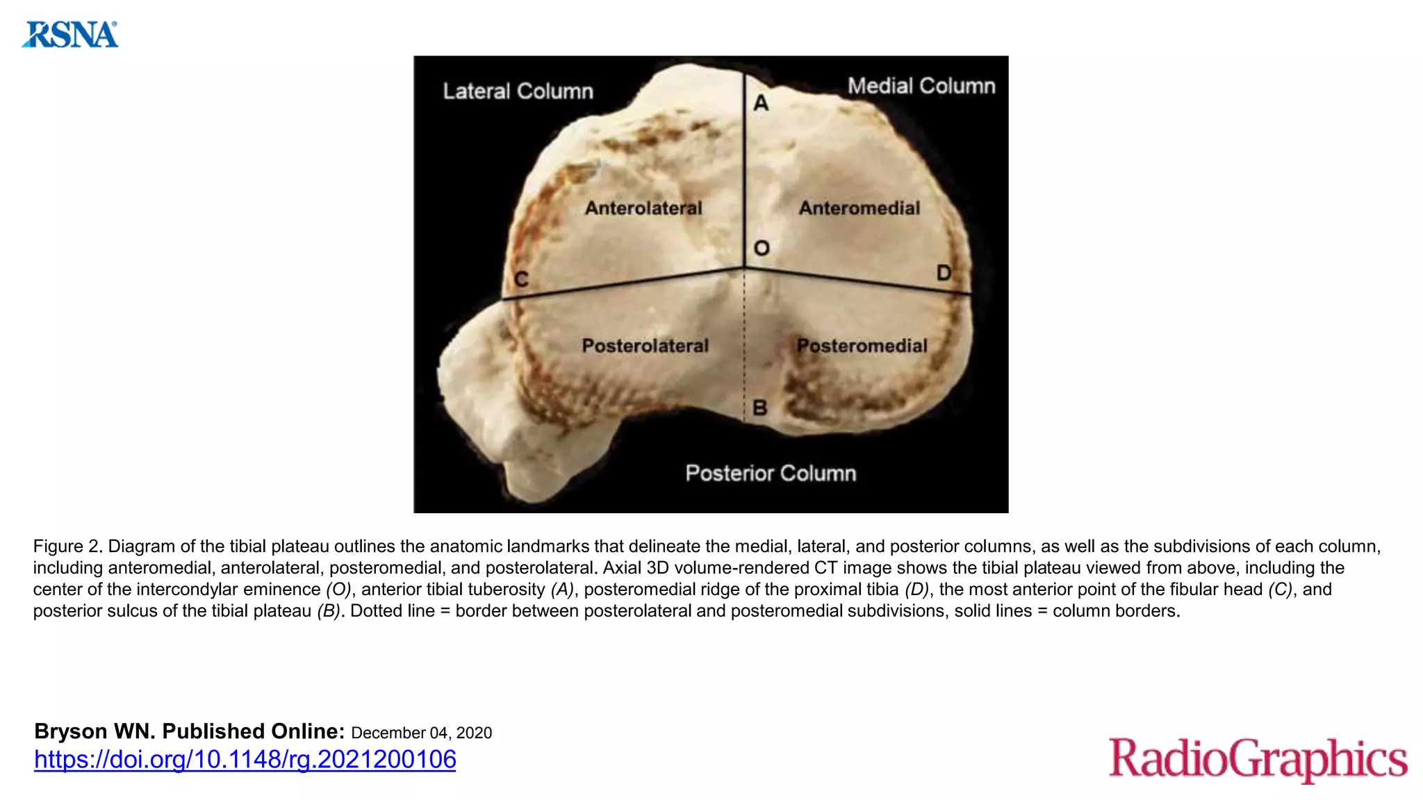 10.1148-rg.2021200106Figure2.pptx.ppt