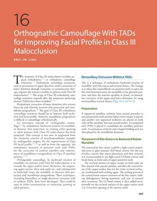 Orthognathic Camouflage With TADs for Improving Facial Profile in Class ...