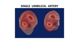 UMBLICAL CORD | PPTX
