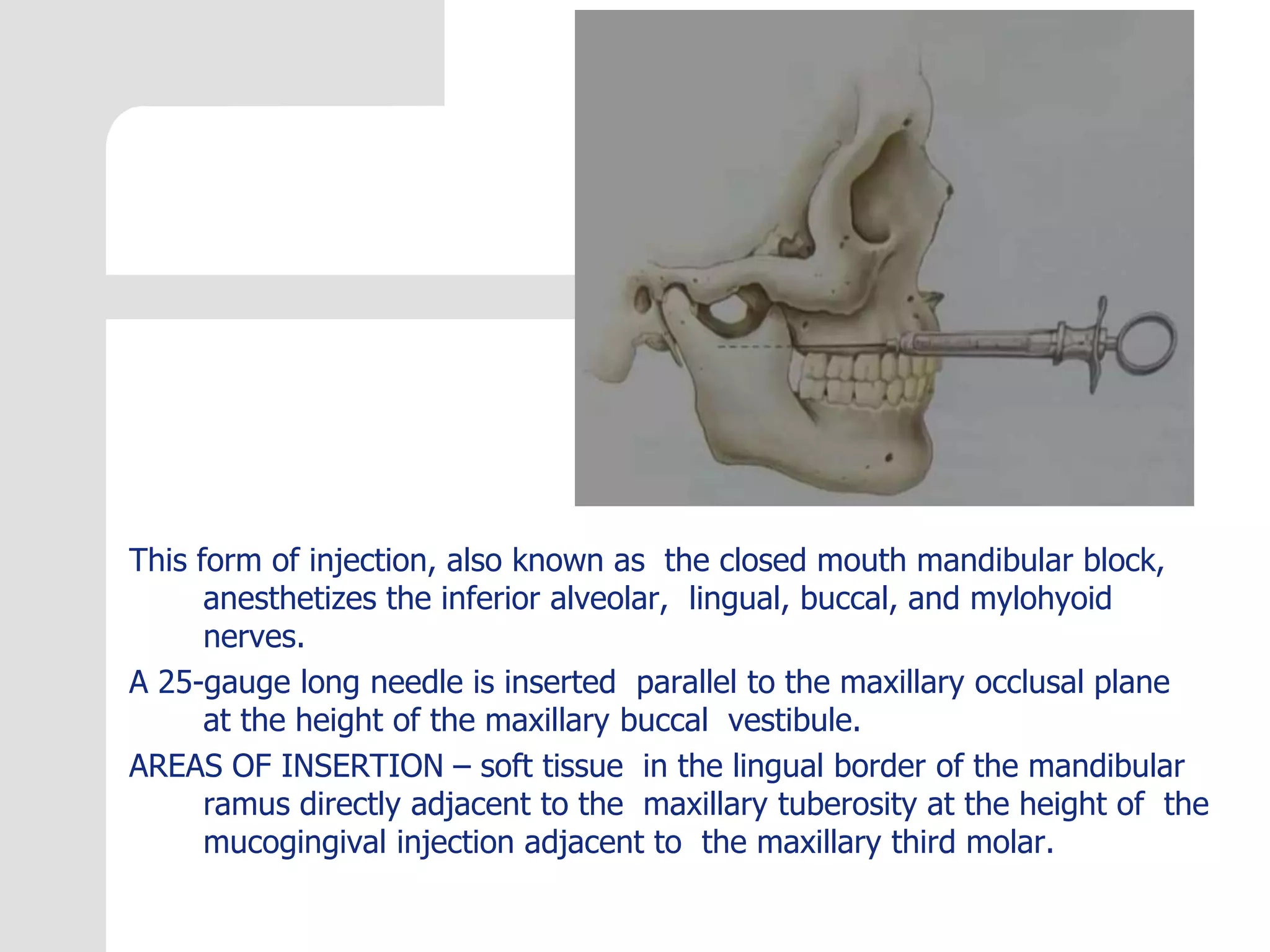 10. mandibular anesthesia.pptx