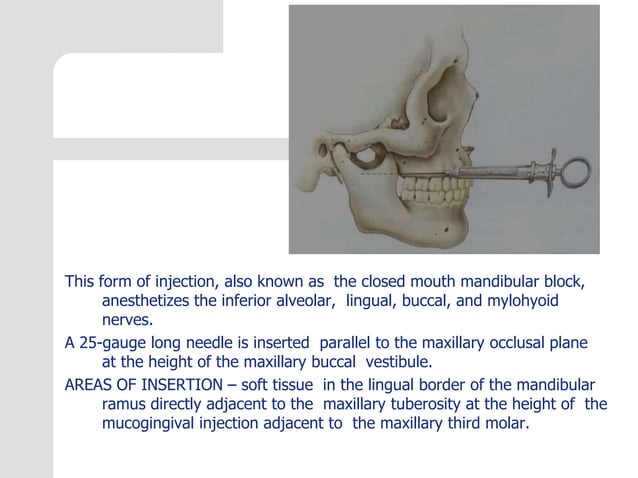 10. mandibular anesthesia.pptx