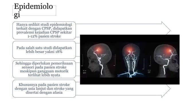 10. Central Post Stroke Pain.pptx