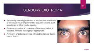 EXOTROPIA.pptx