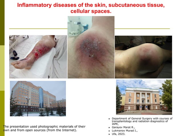 . Inflammatory diseases of the skin, subcutaneous tissue, loose ...