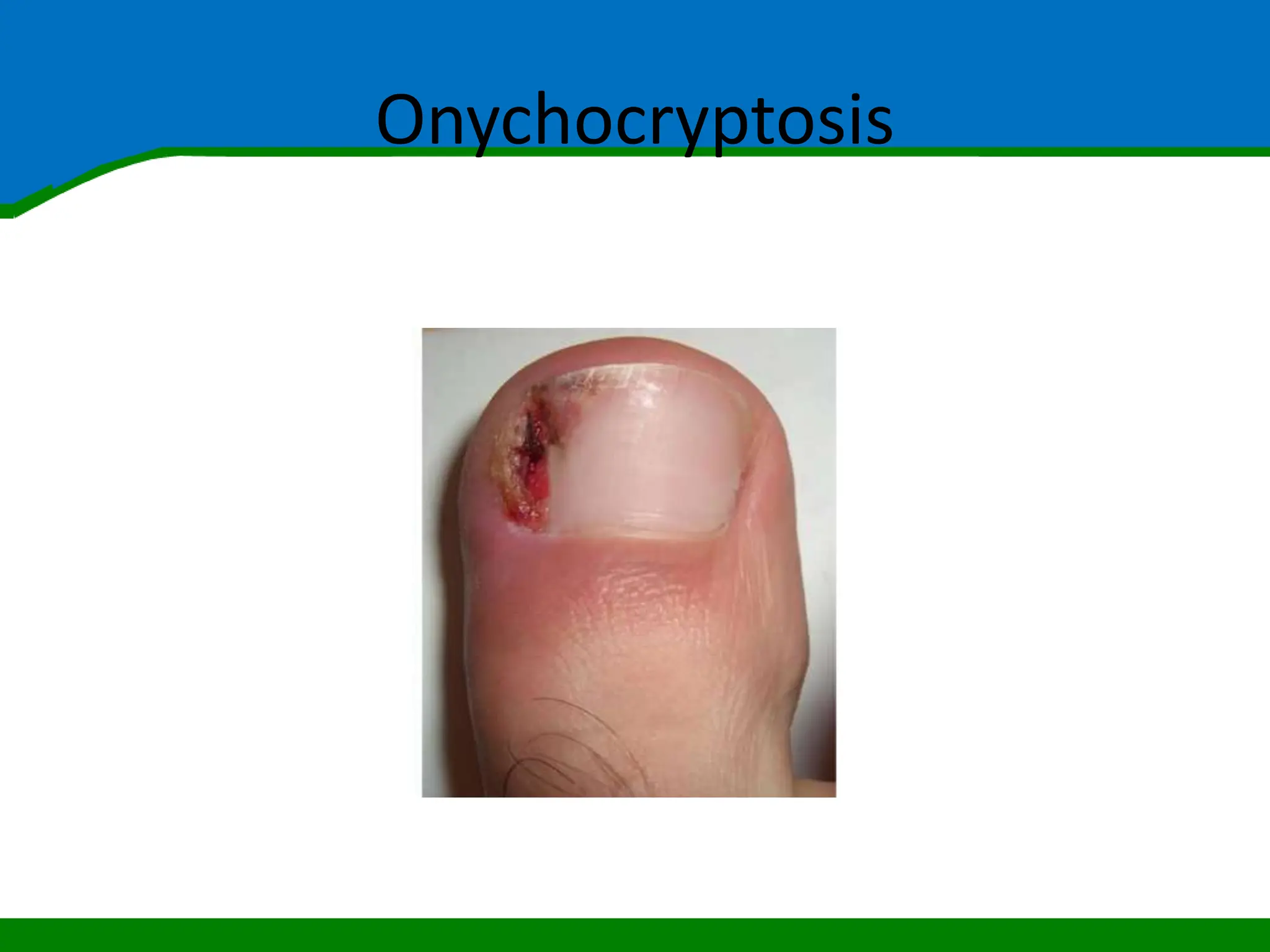 10. nail abnormalities.pptx Dermatolohgy | PPTX | Nail Care | Beauty