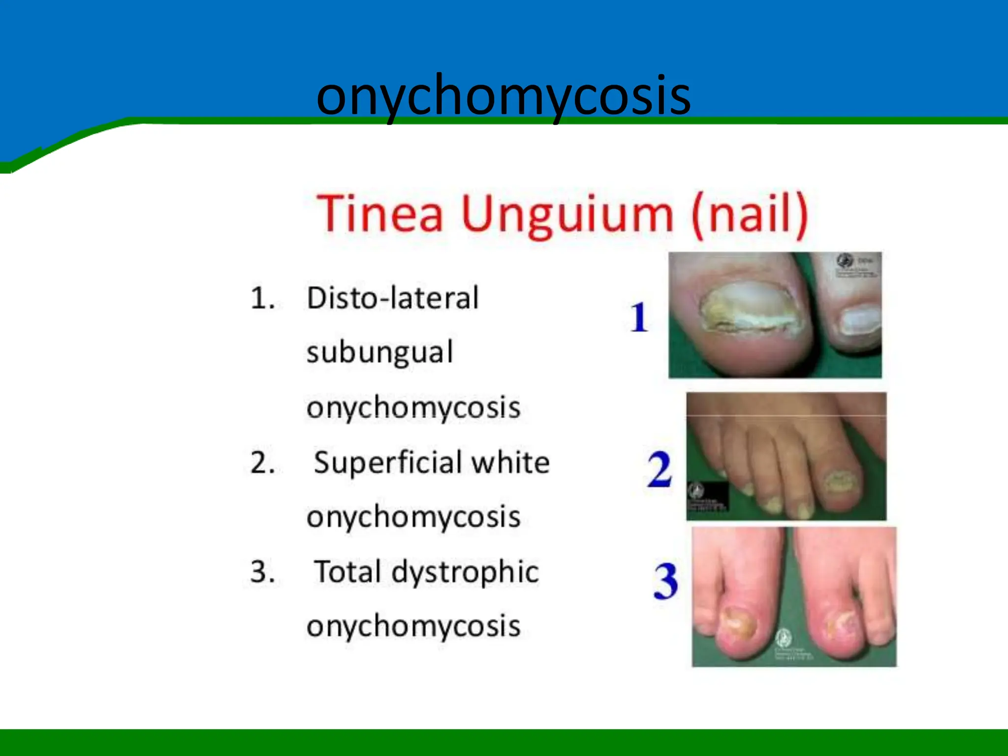 10. nail abnormalities.pptx Dermatolohgy | PPTX | Nail Care | Beauty
