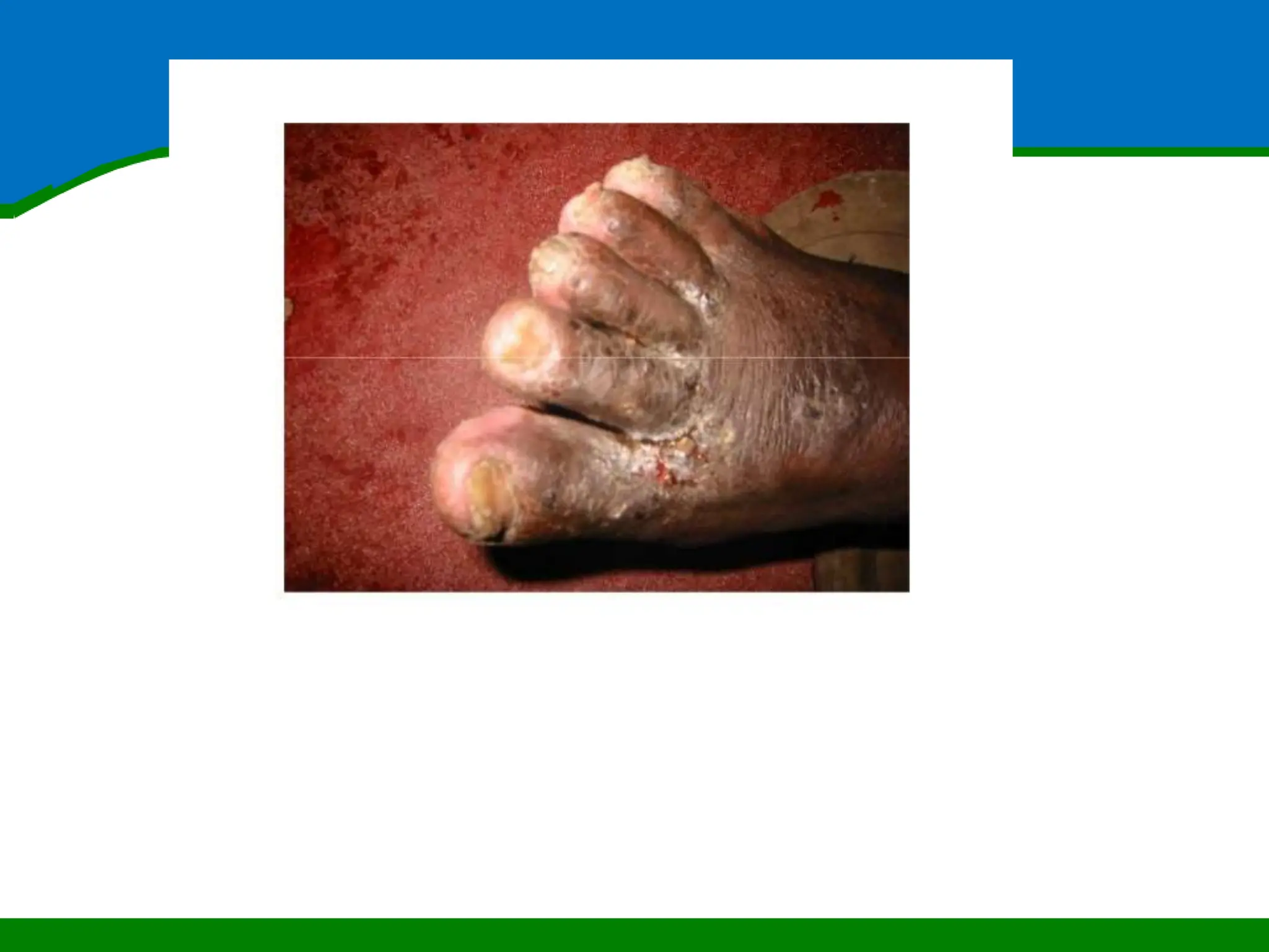 10. nail abnormalities.pptx Dermatolohgy | PPTX | Nail Care | Beauty