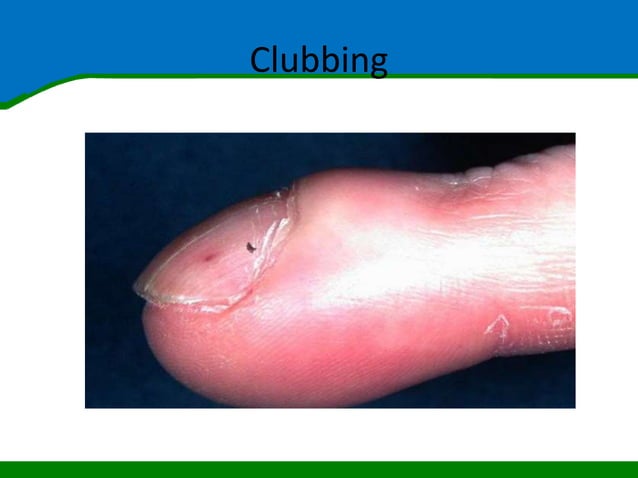 10. nail abnormalities.pptx Dermatolohgy | PPTX | Nail Care | Beauty