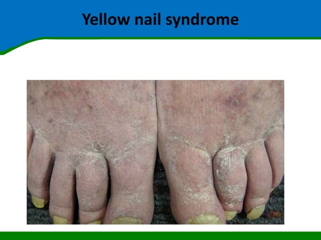 10. nail abnormalities.pptx Dermatolohgy | PPTX | Nail Care | Beauty