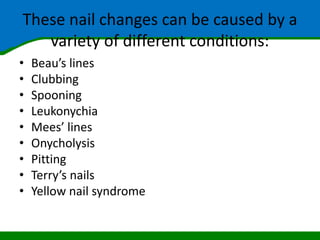10. nail abnormalities.pptx Dermatolohgy | PPT