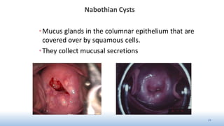 CONCEPTS ON CERVICAL CANCER SCREENING.pptx