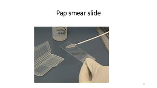 CONCEPTS ON CERVICAL CANCER SCREENING.pptx