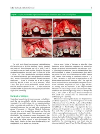 Ujmm tads orthodonticshjhjmnhjnnjjmm .pdf