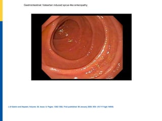 10.1111-jgh....14935Figure149350001.pptx