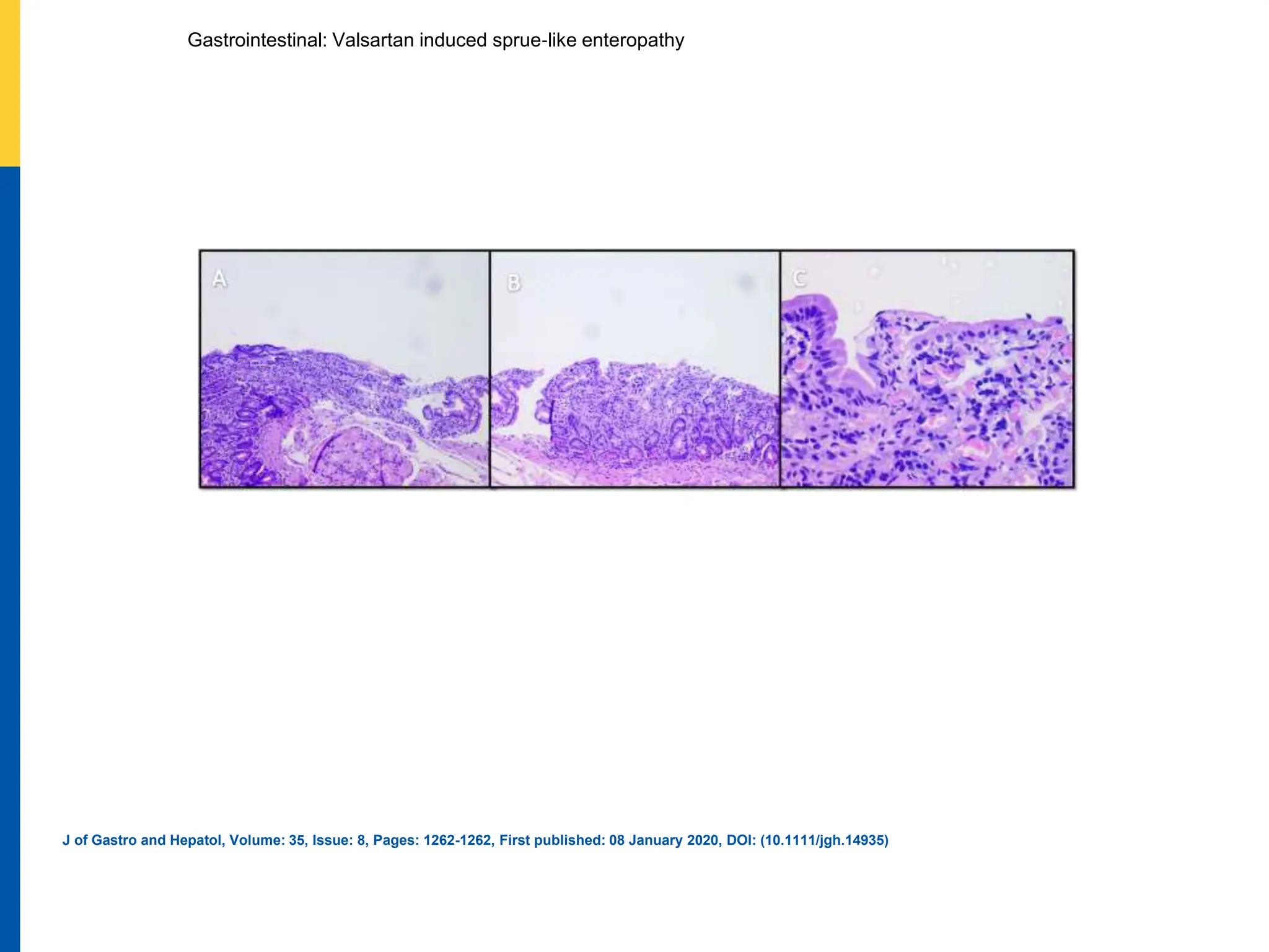 10.1111-jgh....14935Figure149350002.pptx