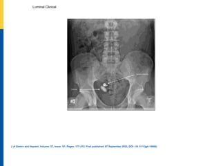 10.1111-jgh.15955Figure1595500240001.pptx | Medical Health