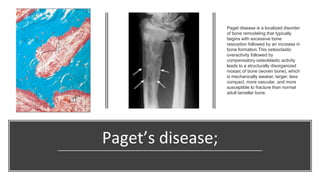 10. bone histology and ossification .pptx