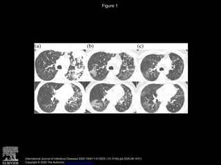 10.1016-j.ijid.2020.09.1431Figure.pptx.ppt