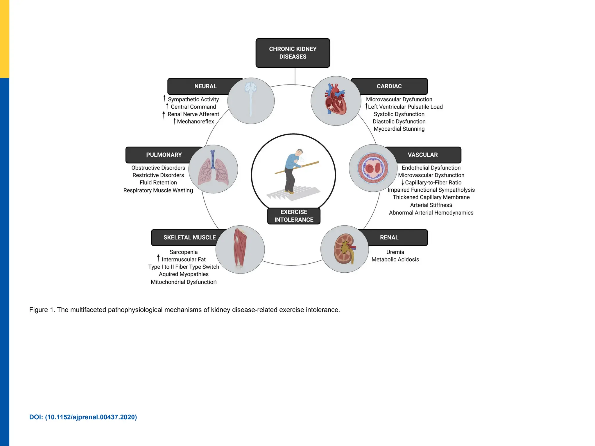The multifaceted pathophysiological mechanisms of kidney disease ...