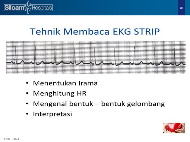 10. PEREKAMAN DAN INTERPRETASI EKG (2).pptx