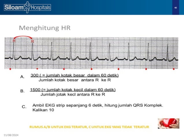 10. PEREKAMAN DAN INTERPRETASI EKG (2).pptx