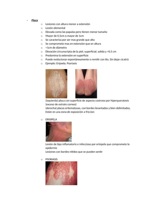 10. LESIONES DE LA PIEL diagnosticadas desd un hospital univesitario.docx