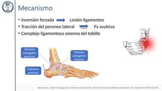 Esguince de tobillo Esguince de tobillo Esguin | PPTX