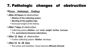 10.Upper Urinary Tract Obstruction.........pptx