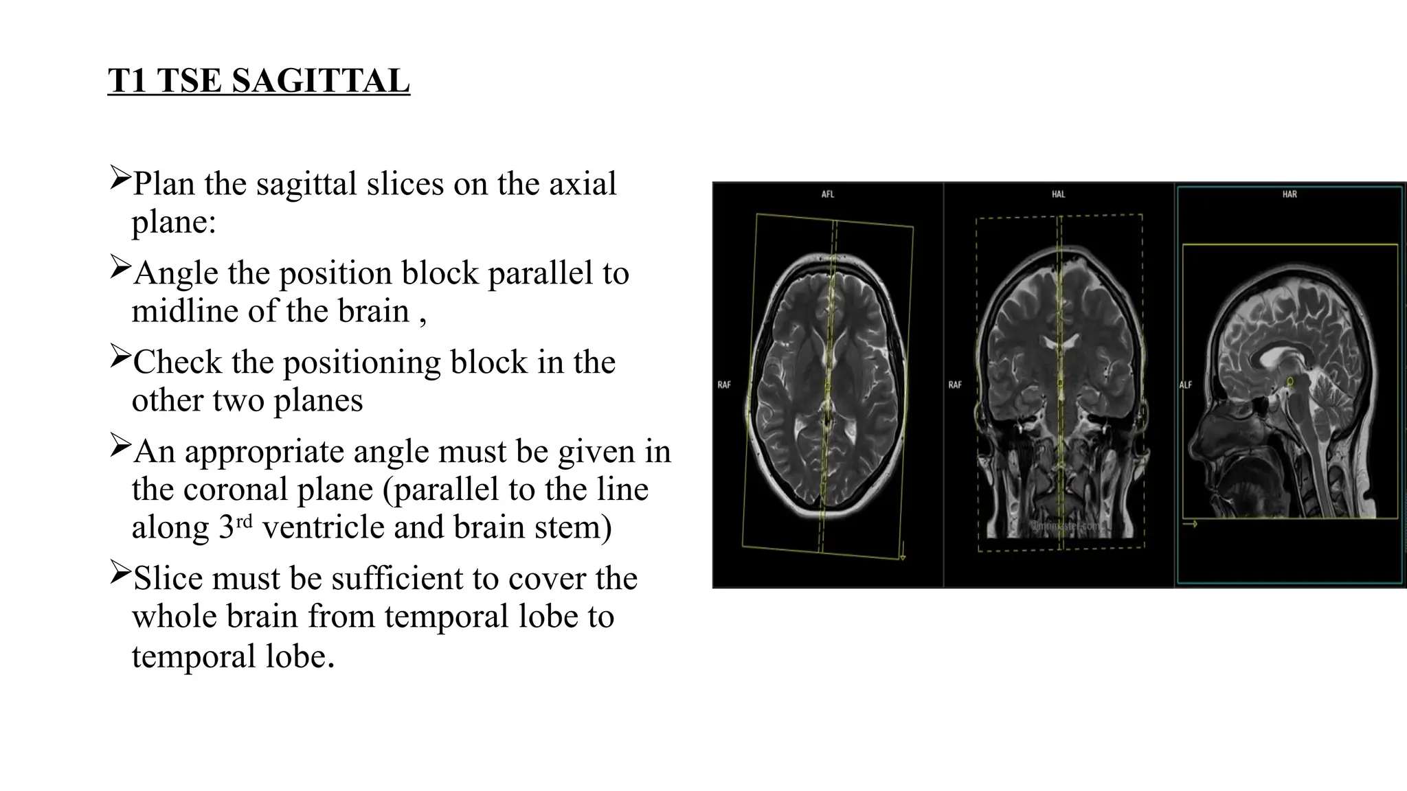 10.MRI Brain Epilepsy (Seizure) Protocol-2.pptx