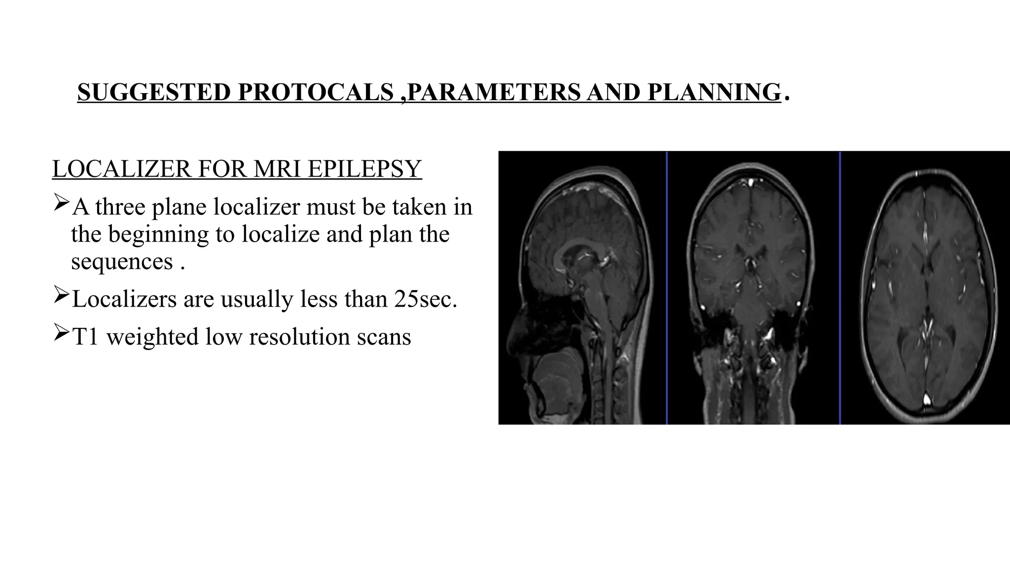 10.MRI Brain Epilepsy (Seizure) Protocol-2.pptx