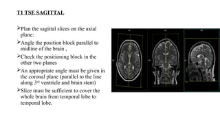 10.MRI Brain Epilepsy (Seizure) Protocol-2.pptx