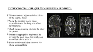 10.MRI Brain Epilepsy (Seizure) Protocol-2.pptx