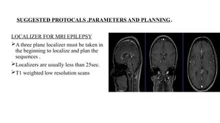 10.MRI Brain Epilepsy (Seizure) Protocol-2.pptx