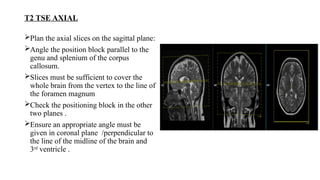 10.MRI Brain Epilepsy (Seizure) Protocol-2.pptx