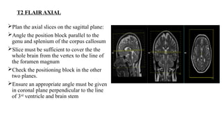 10.MRI Brain Epilepsy (Seizure) Protocol-2.pptx