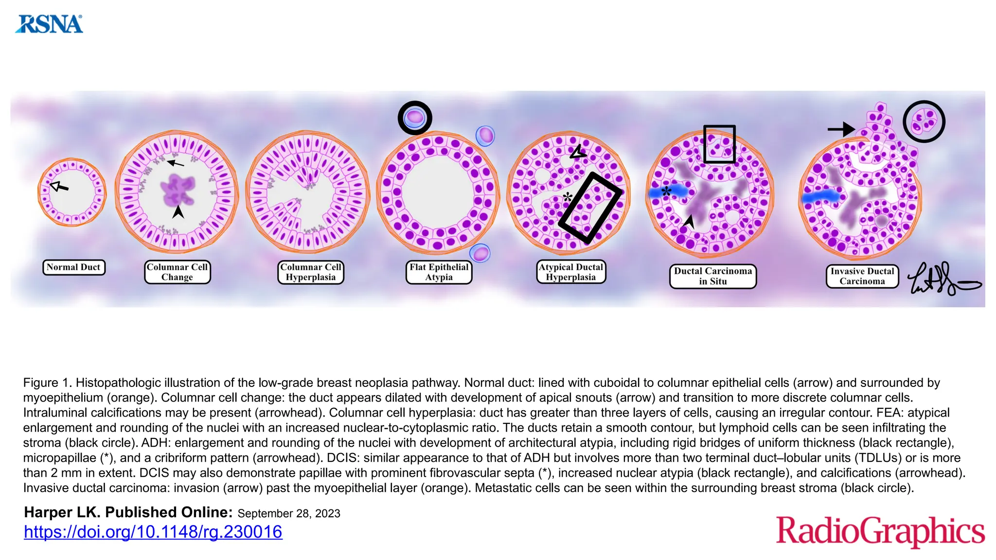 Journal of Mammary Gland Biology and Neoplasia | PPTX
