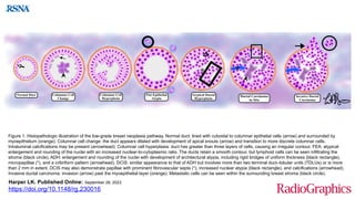 Journal of Mammary Gland Biology and Neoplasia | PPT