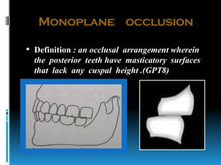 10. Occlusion and it's types in complete dentures | PDF