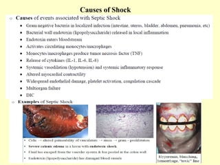 10. Shock.ppt shock In internal medicine | PPT