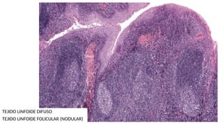 10.LINFOIDE.pptx histologia cátedra histologia | PPTX