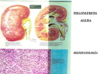 10.- INFECCION URINARIA gaby nefrol. ppt | PPT