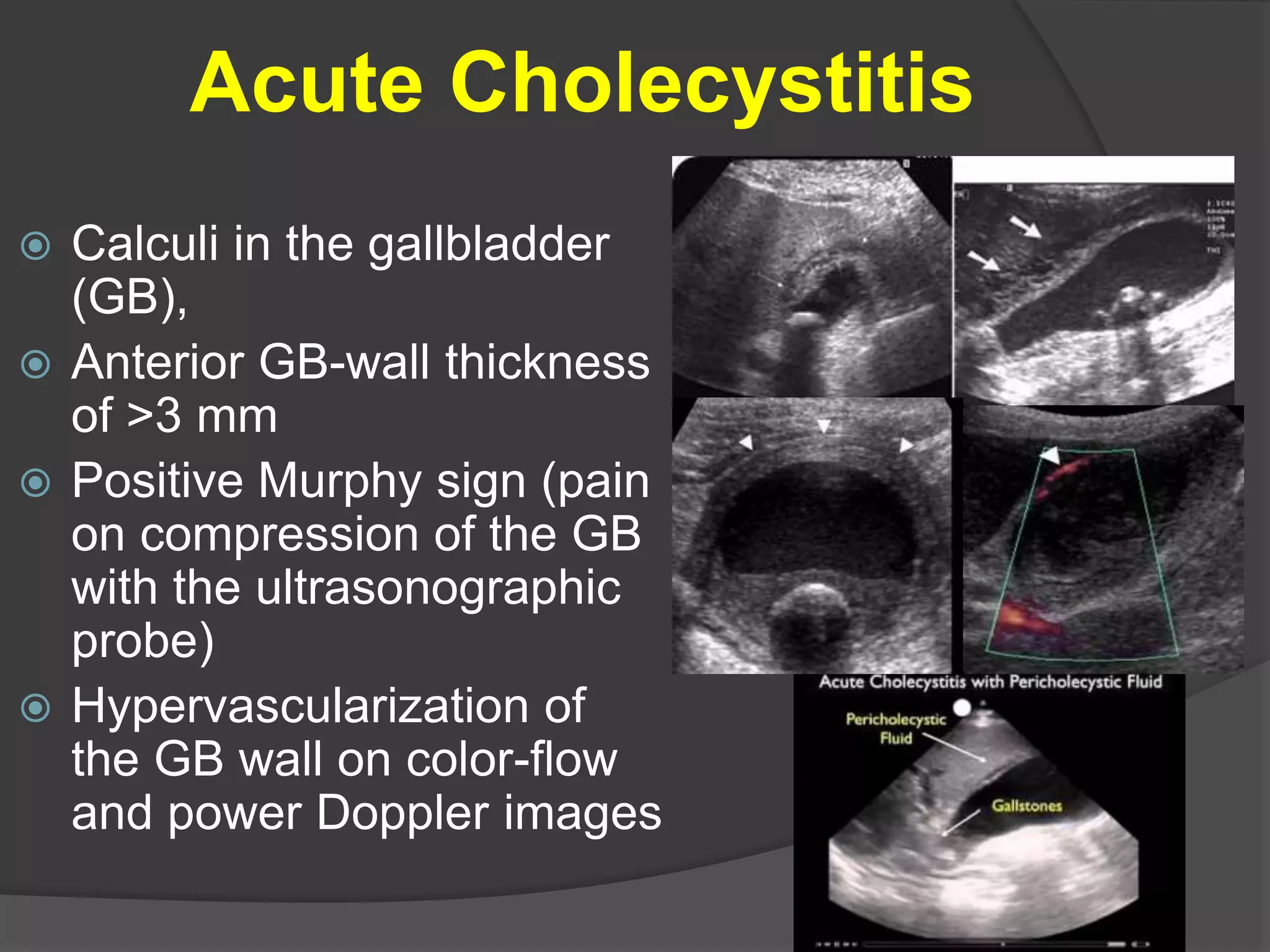 10 - acute abdomen 1 | PPTX