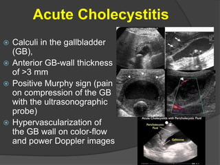 10 - acute abdomen 1 | PPTX