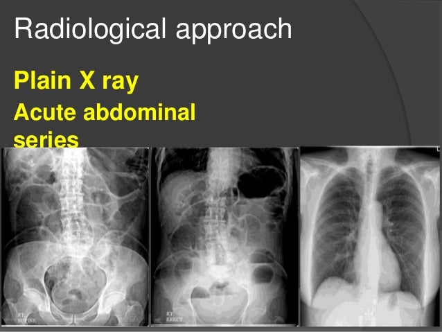 10 - acute abdomen 1