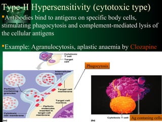 Adverse drug reactionsvpp | PPT