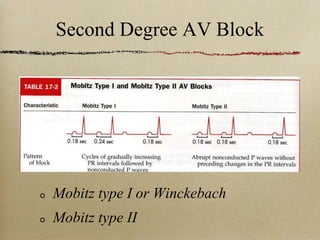 10-AV-blocks.ppt